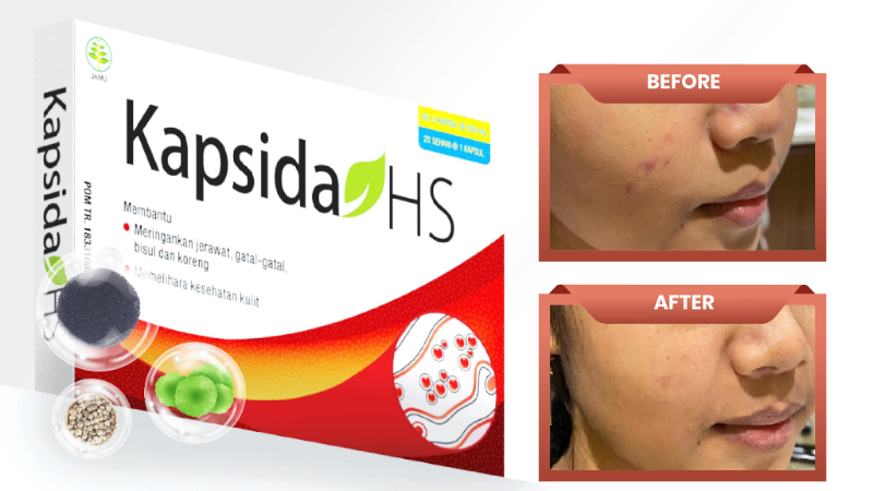 Harga Kapsida HS di Alfamart, Indomaret, & Apotek Terkini | Harga.web.id