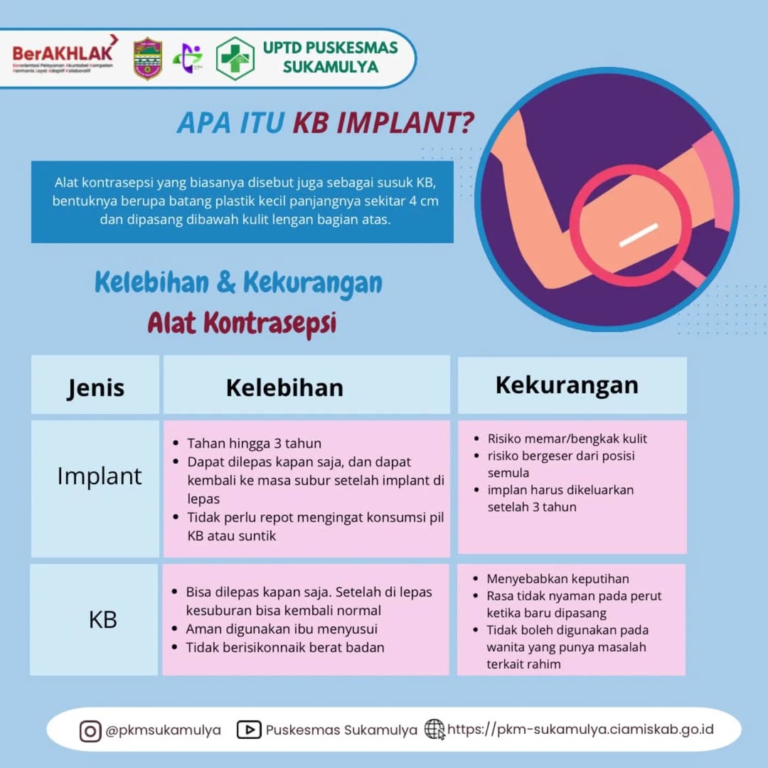 Info Biaya Pasang KB Implan/Susuk | Harga.web.id